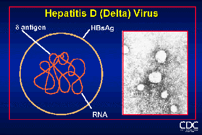 Hepatitis D VHD :: Microbiologiaudca