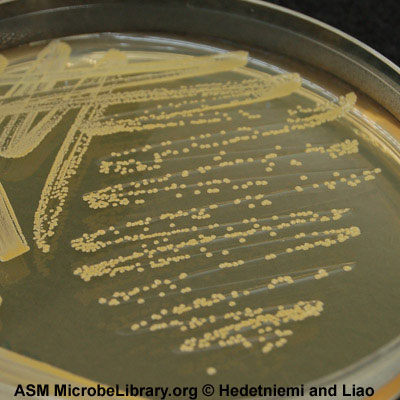 Staphylococcus epidermidis :: Microbiologiaudca